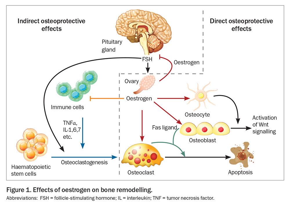 Bone health during the menopause: assessment and fracture prevention | Endocrinology Today